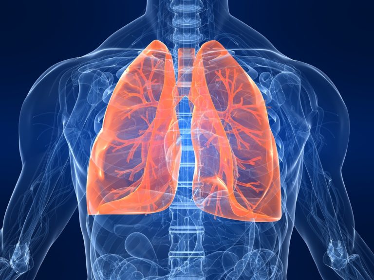 Ozone Therapy Shows Promise in Treating Sepsis-induced Lung Injury ...